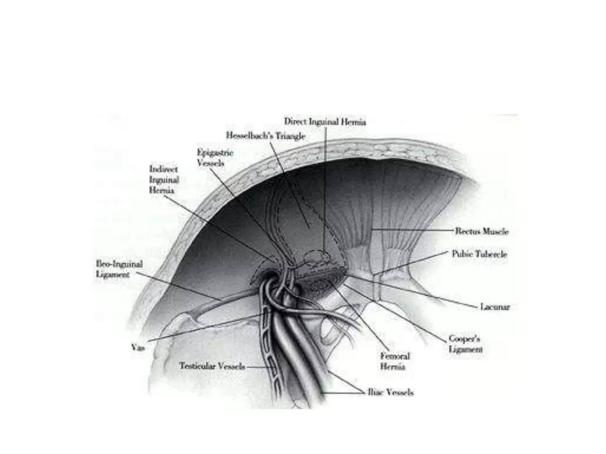 Inguinal anatomy | PPTX