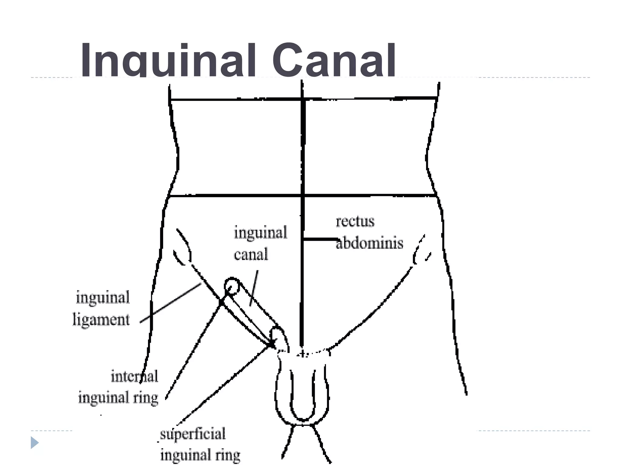 Inguinal And Femoral Hernia Ppt