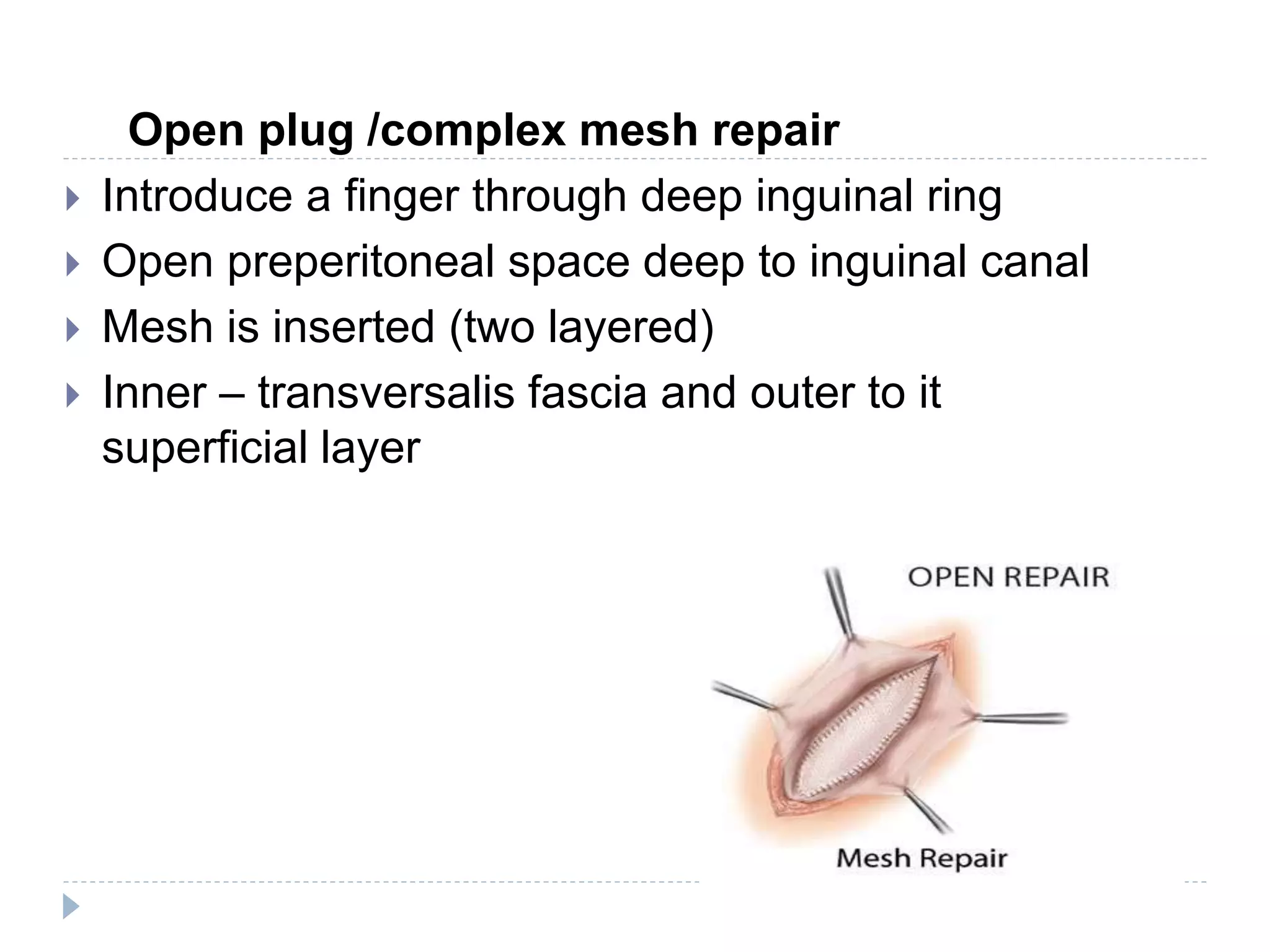 Inguinal and Femoral hernia | PPTX