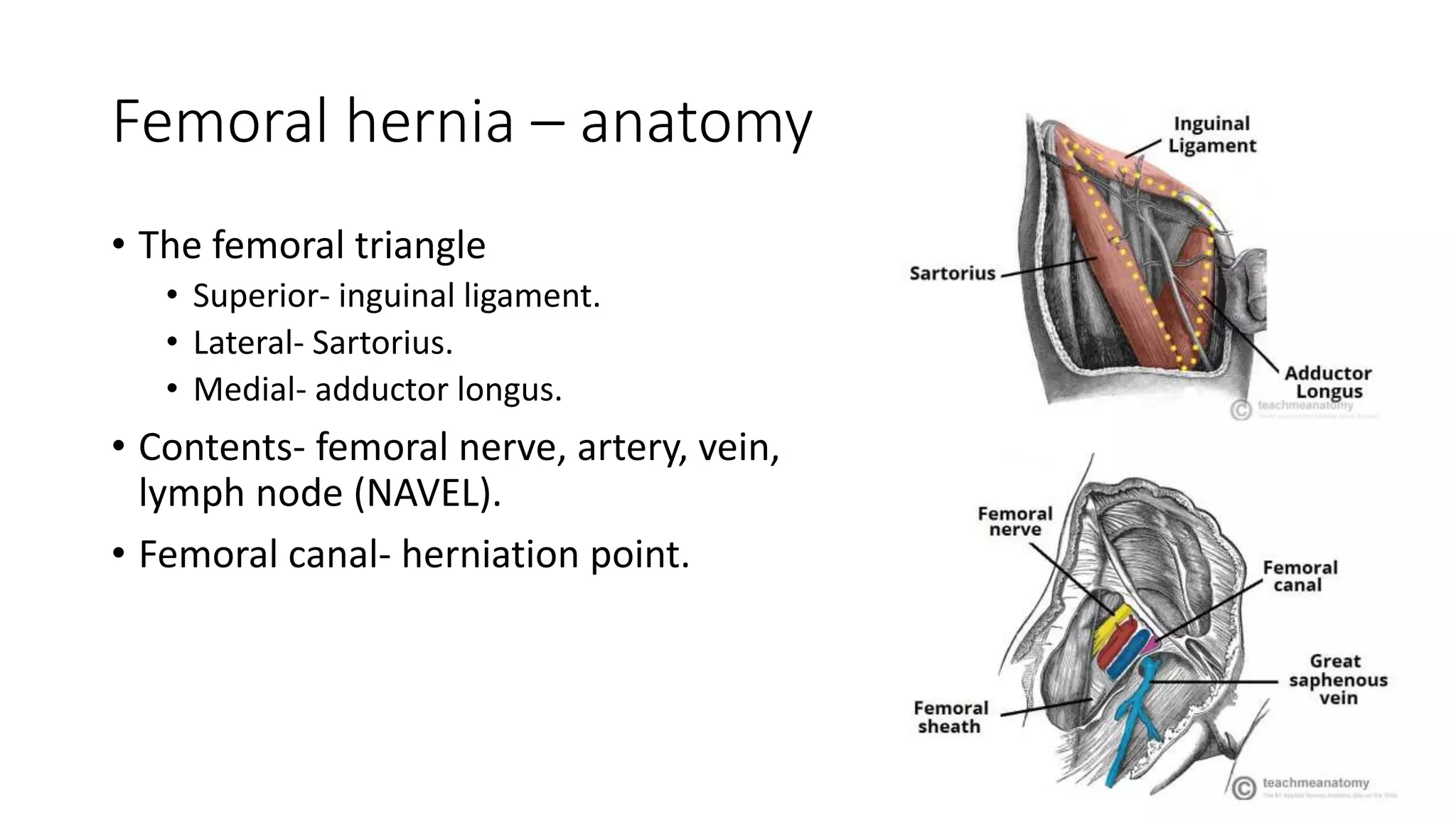 Inguinal and femoral hernia | PPTX