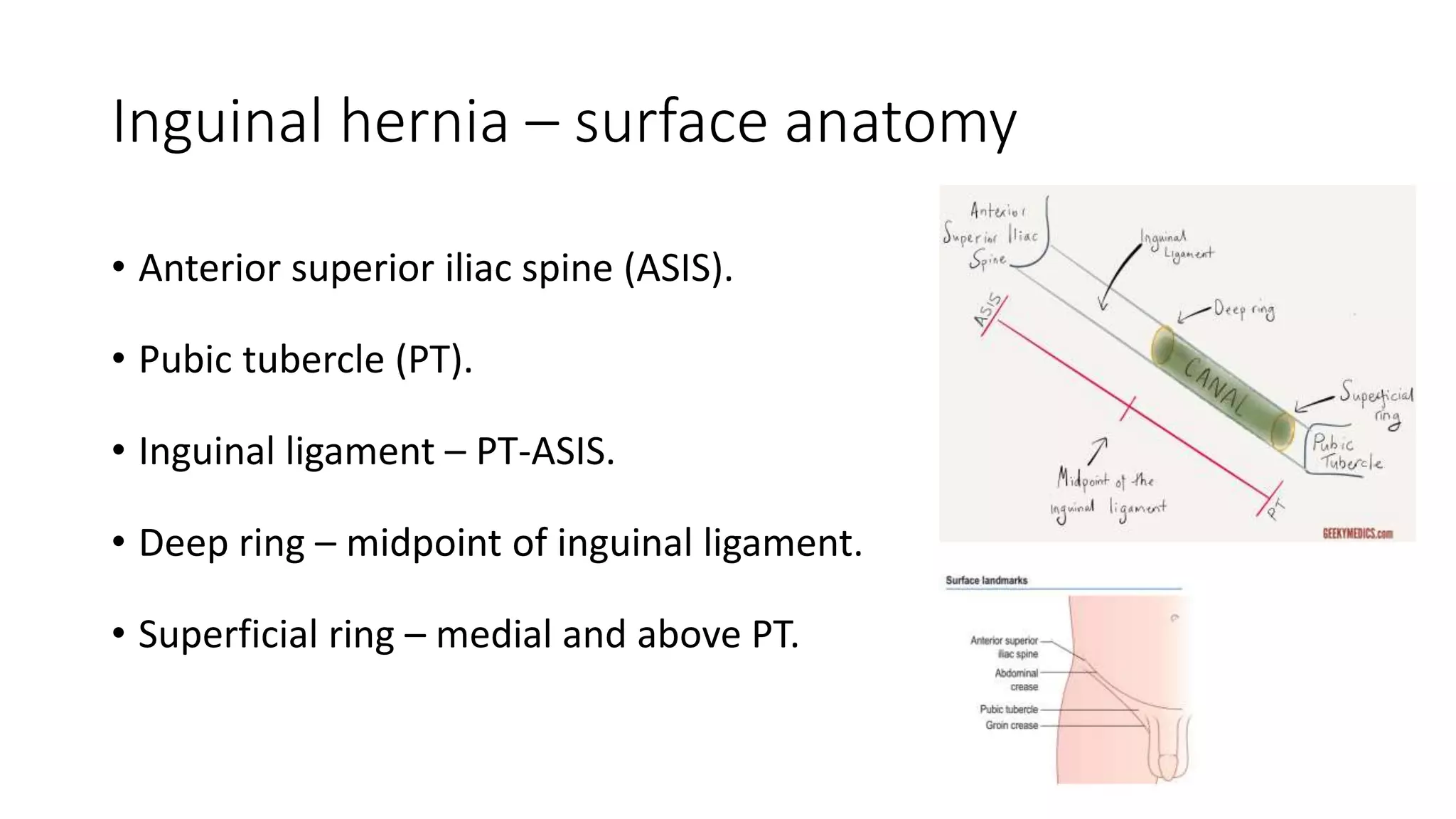 Inguinal and femoral hernia | PPTX