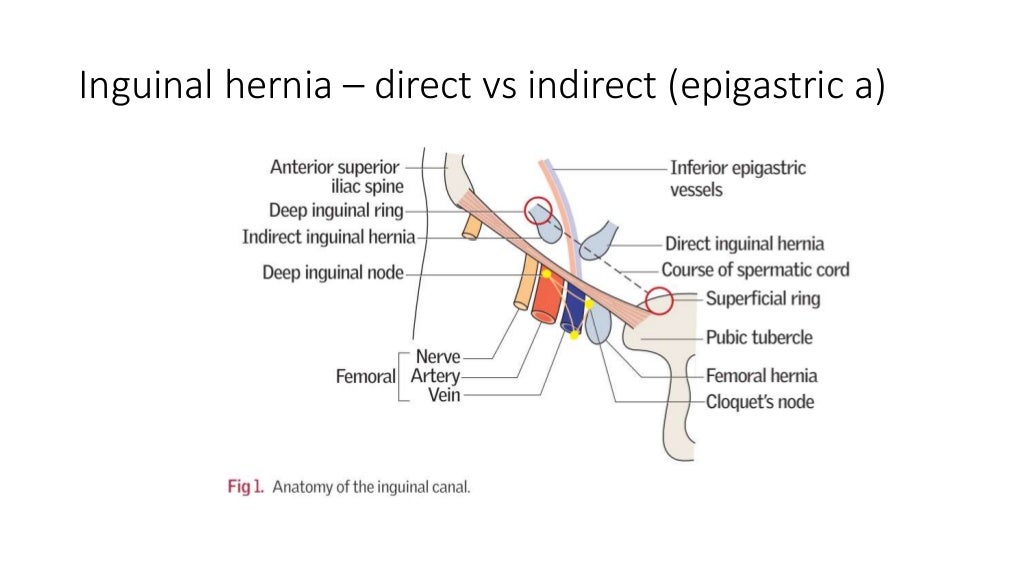 Inguinal And Femoral Hernias Inguinal Canal Anatomy G