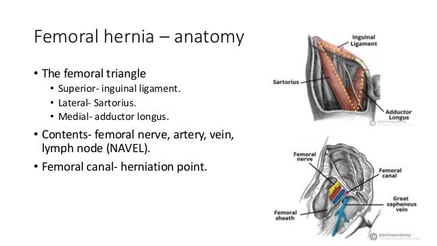Femoral Hernia Anatomy