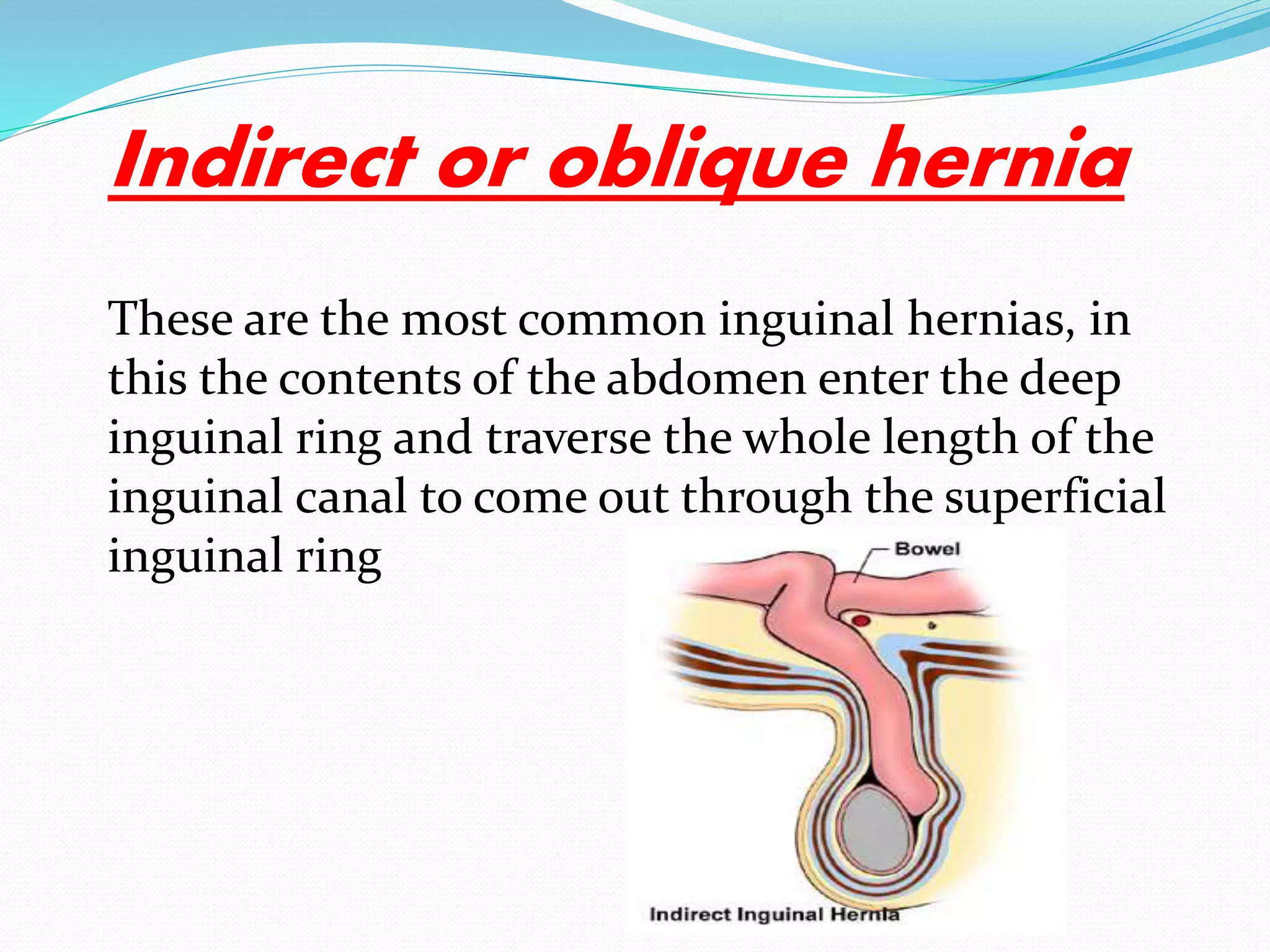 surgical anatomy Inguinal canal anatomy dr.vishnu | PPTX