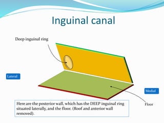 surgical anatomy Inguinal canal anatomy dr.vishnu | PPTX