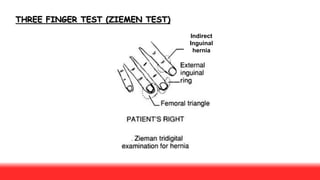 Inguinal canal final | PPTX
