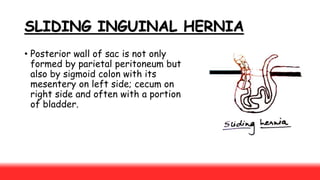 Sliding Inguinal Hernia