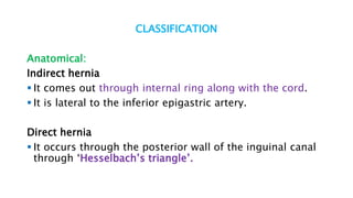 Inguinal hernia | PPTX