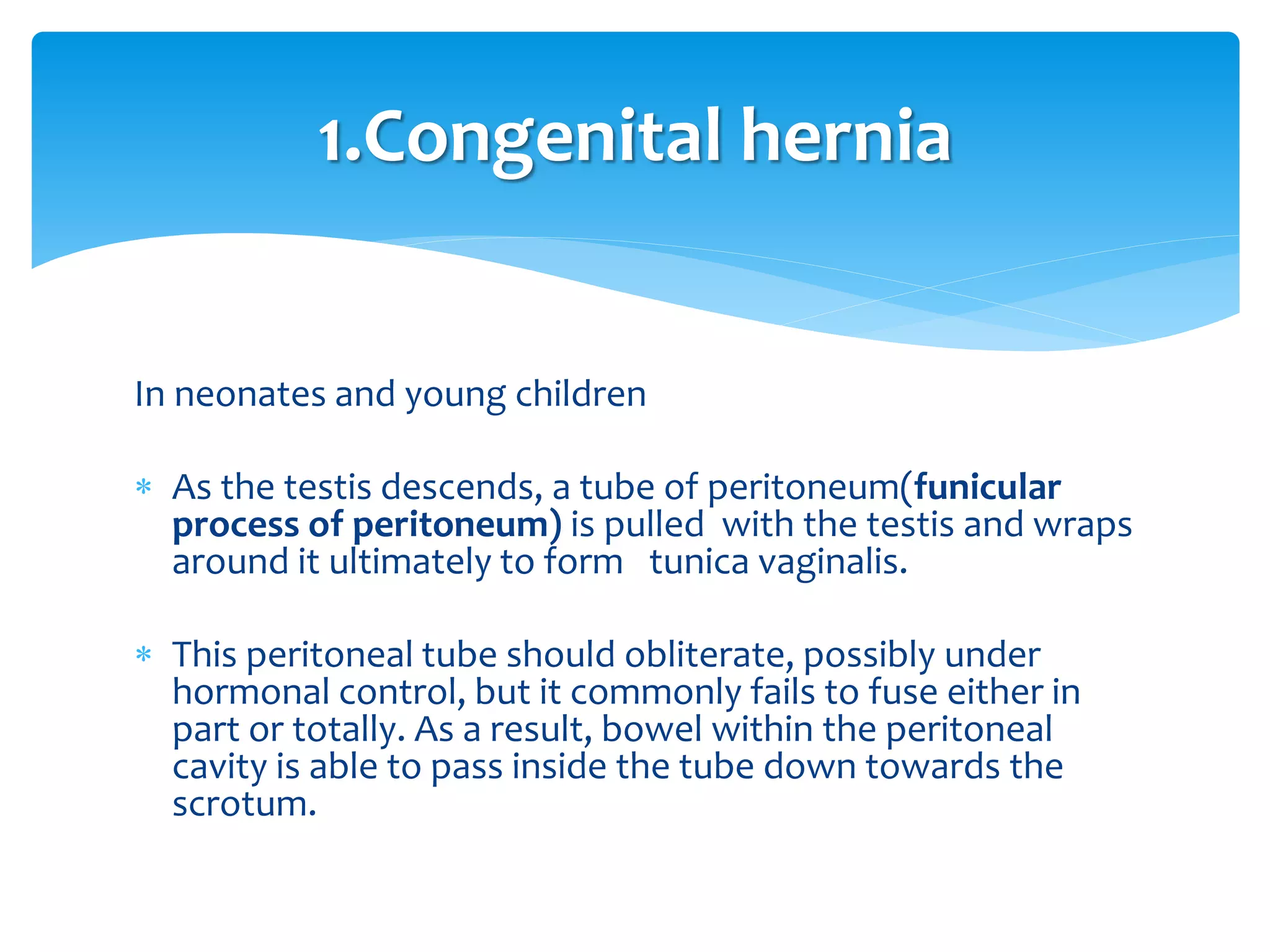 Inguinal hernia | PPTX