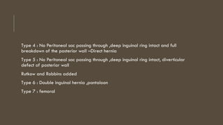 Inguinal Hernia.pptx kist general surgery | PPTX