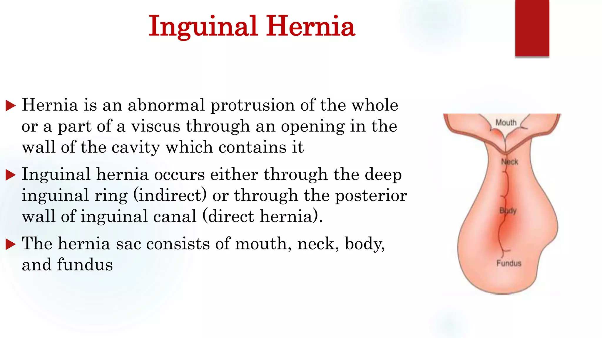 Inguinal Hernia- Groin Swellings | PPTX
