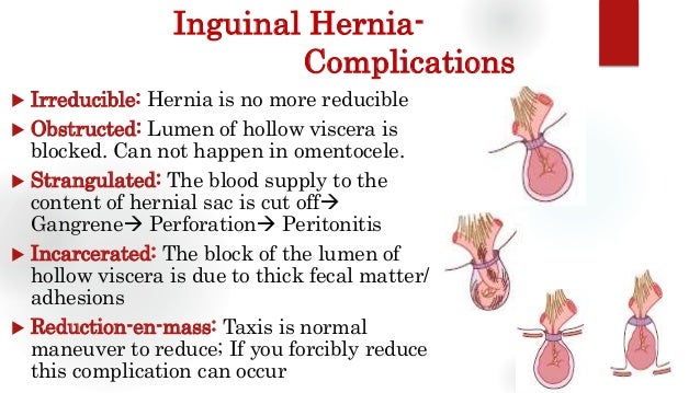 Inguinal Hernia- Groin Swellings