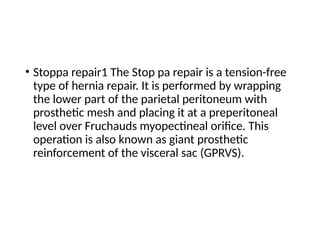 Inguinal hernia-thomas.pptx how to repair inguinal hernia | PPT