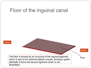 Inguinal hernia | PPTX