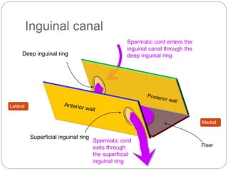 Inguinal hernia | PPT