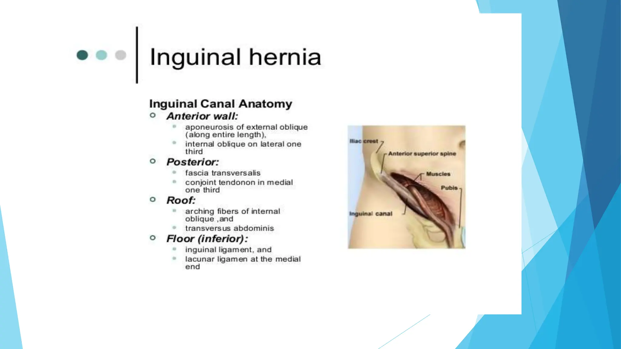 inguinal hernia 2 ,theory part for surgery .pptx | Surgery | Medical Health