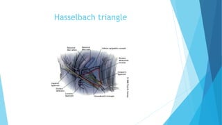 inguinal hernia 2 ,theory part for surgery .pptx | Surgery | Medical Health
