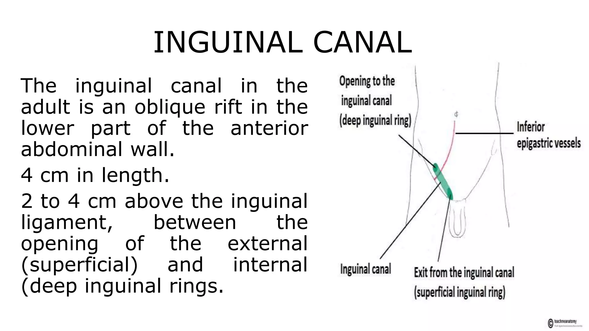 Inguinal hernia and its management | PPTX