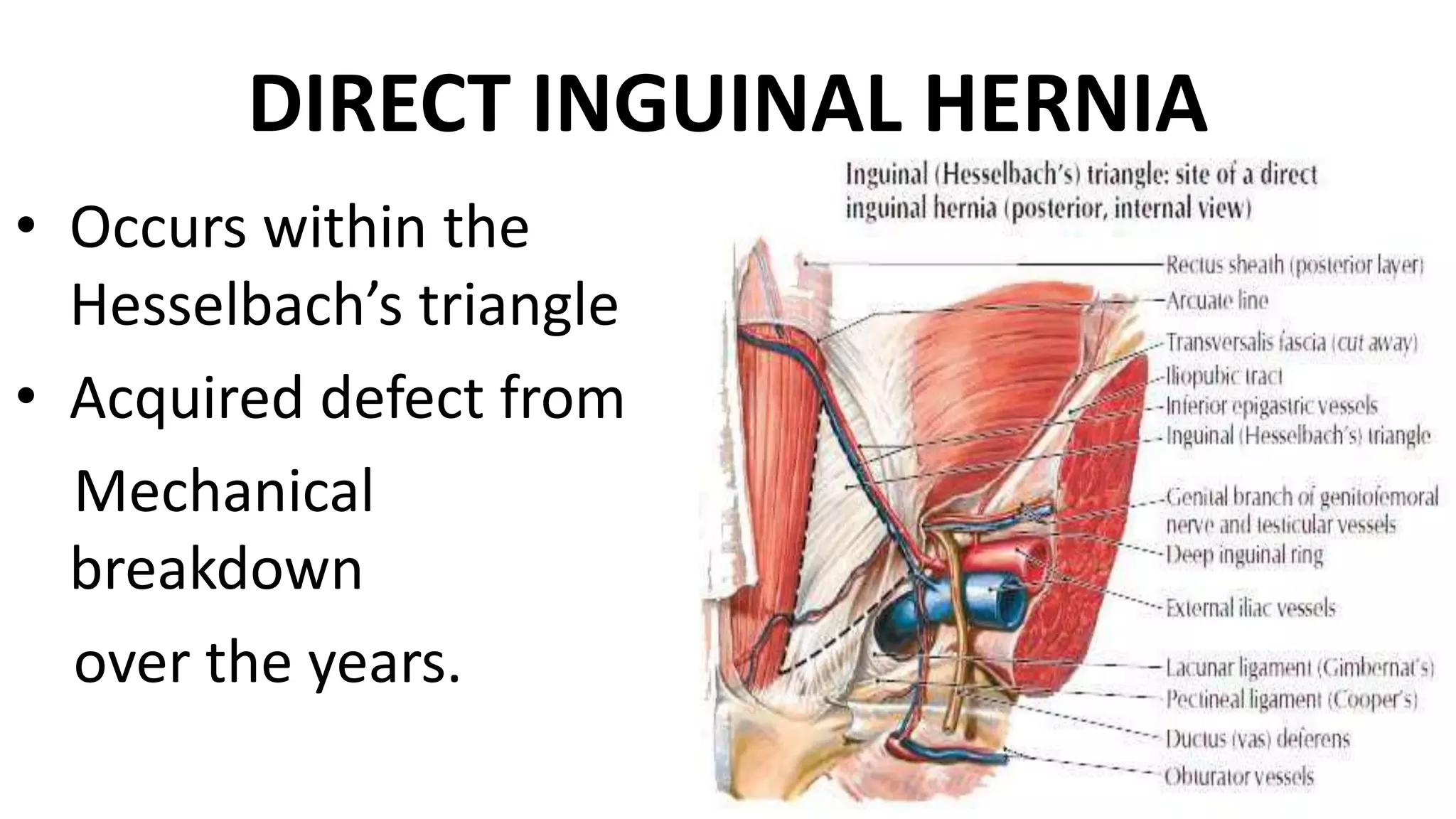 Inguinal hernia and its management | PPTX