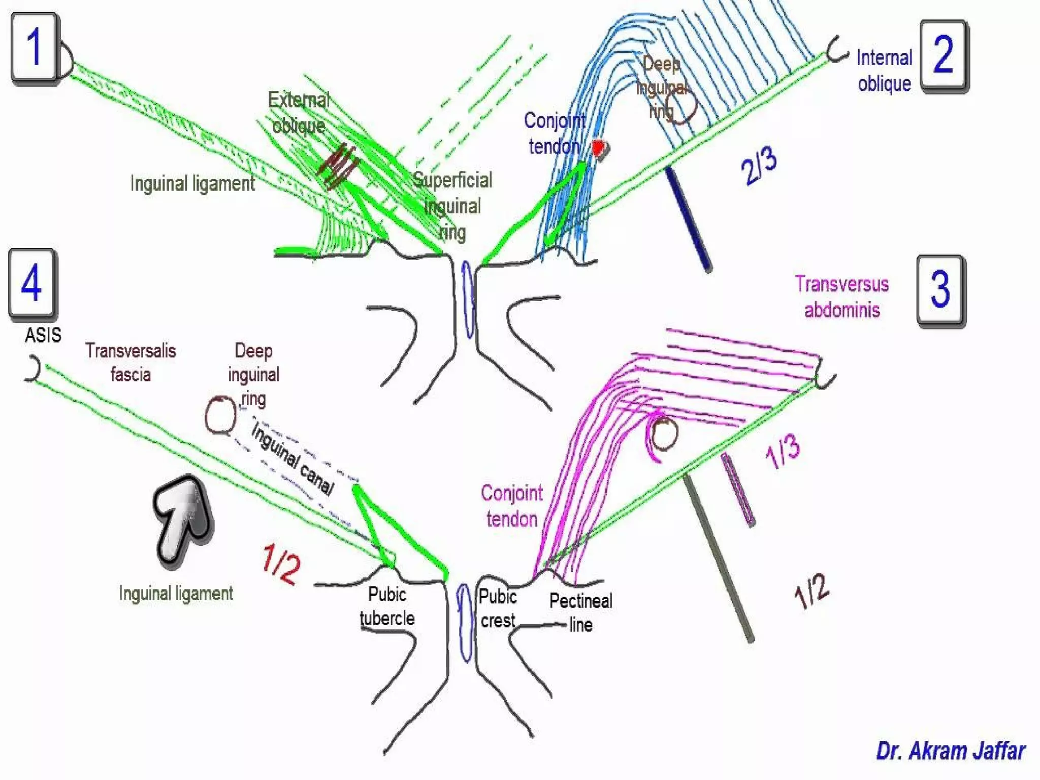 Inguinal hernia examination | PPT