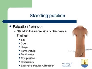 Inguinal hernia examination | PPT