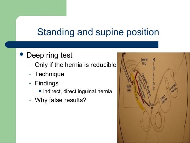 Inguinal Hernia Examination