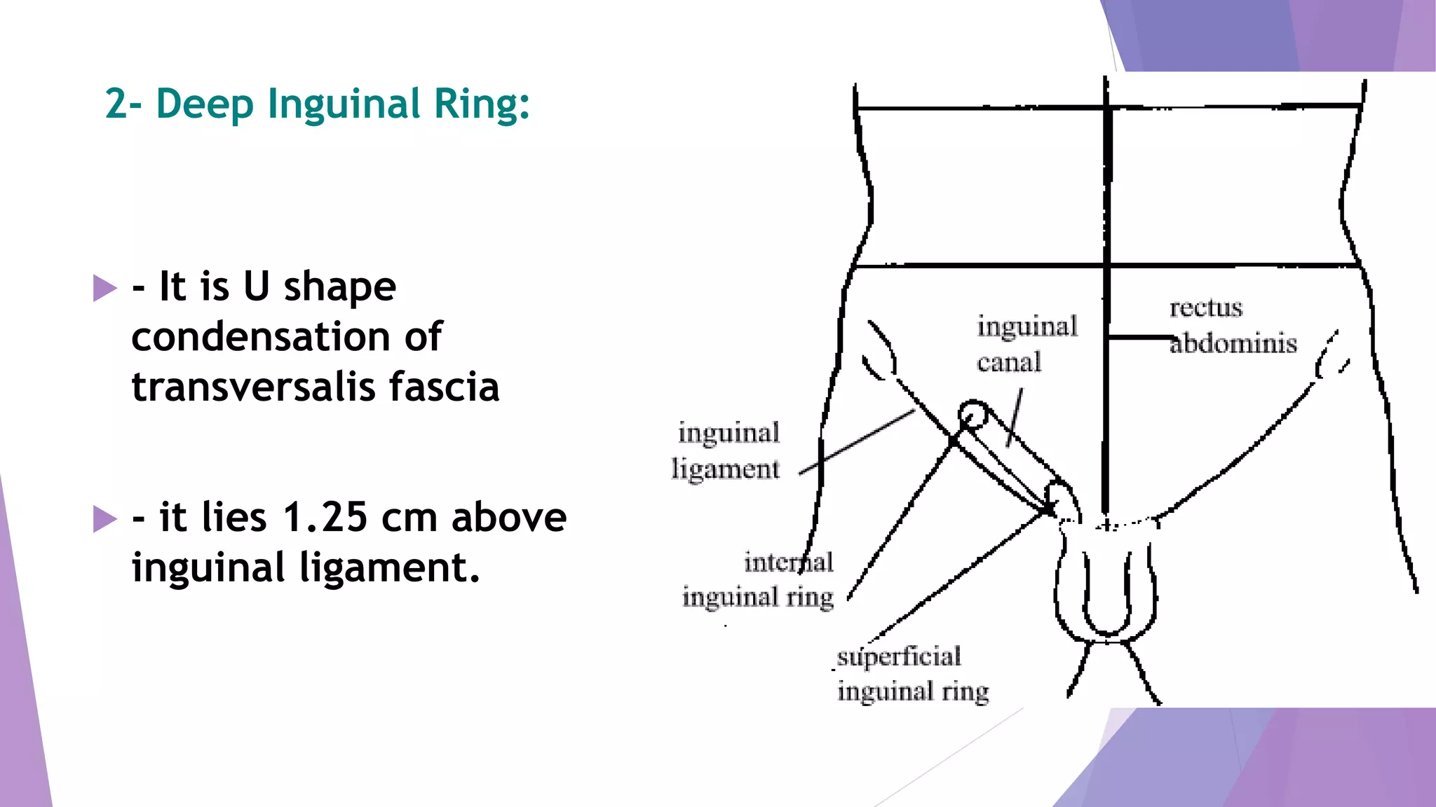 Inguinal hernia | PPTX