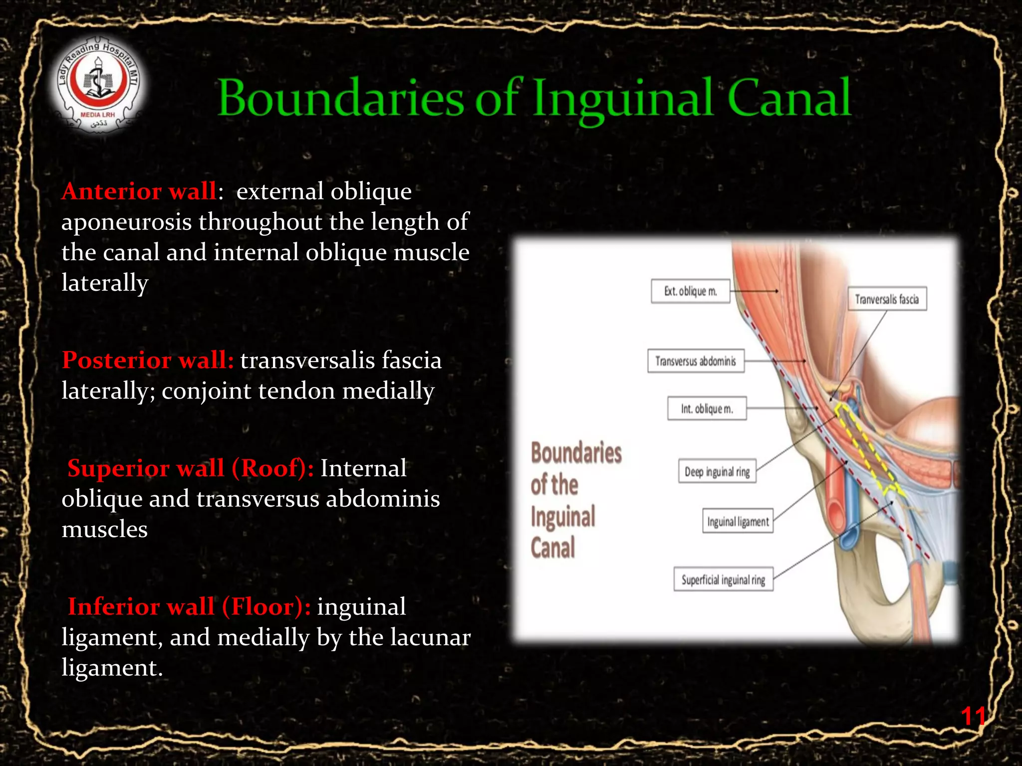 Inguinal Hernia Management, Presentation, by Dr. Shabir Ahmad | PPT