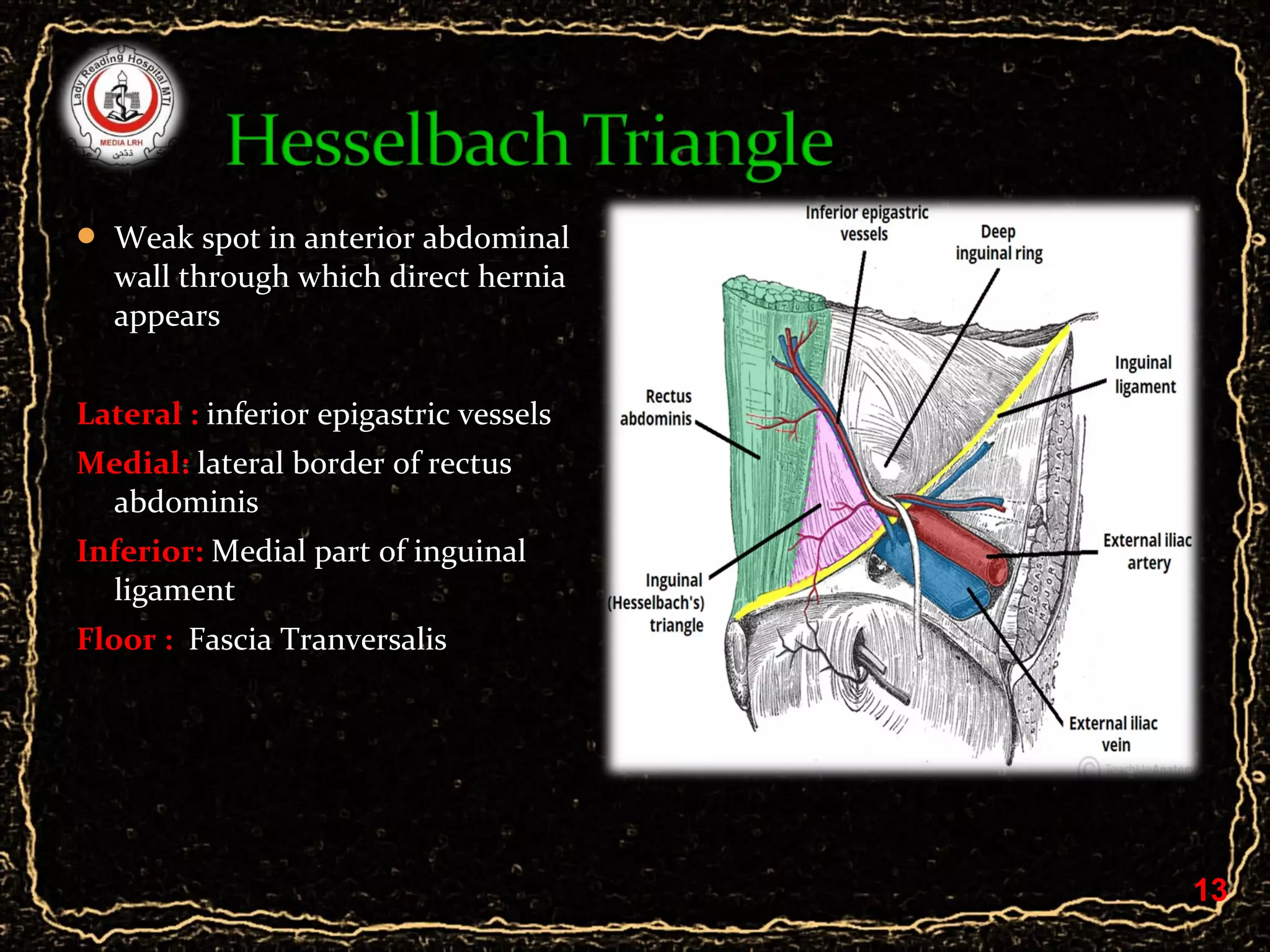 Inguinal Hernia Management, Presentation, by Dr. Shabir Ahmad | PPT