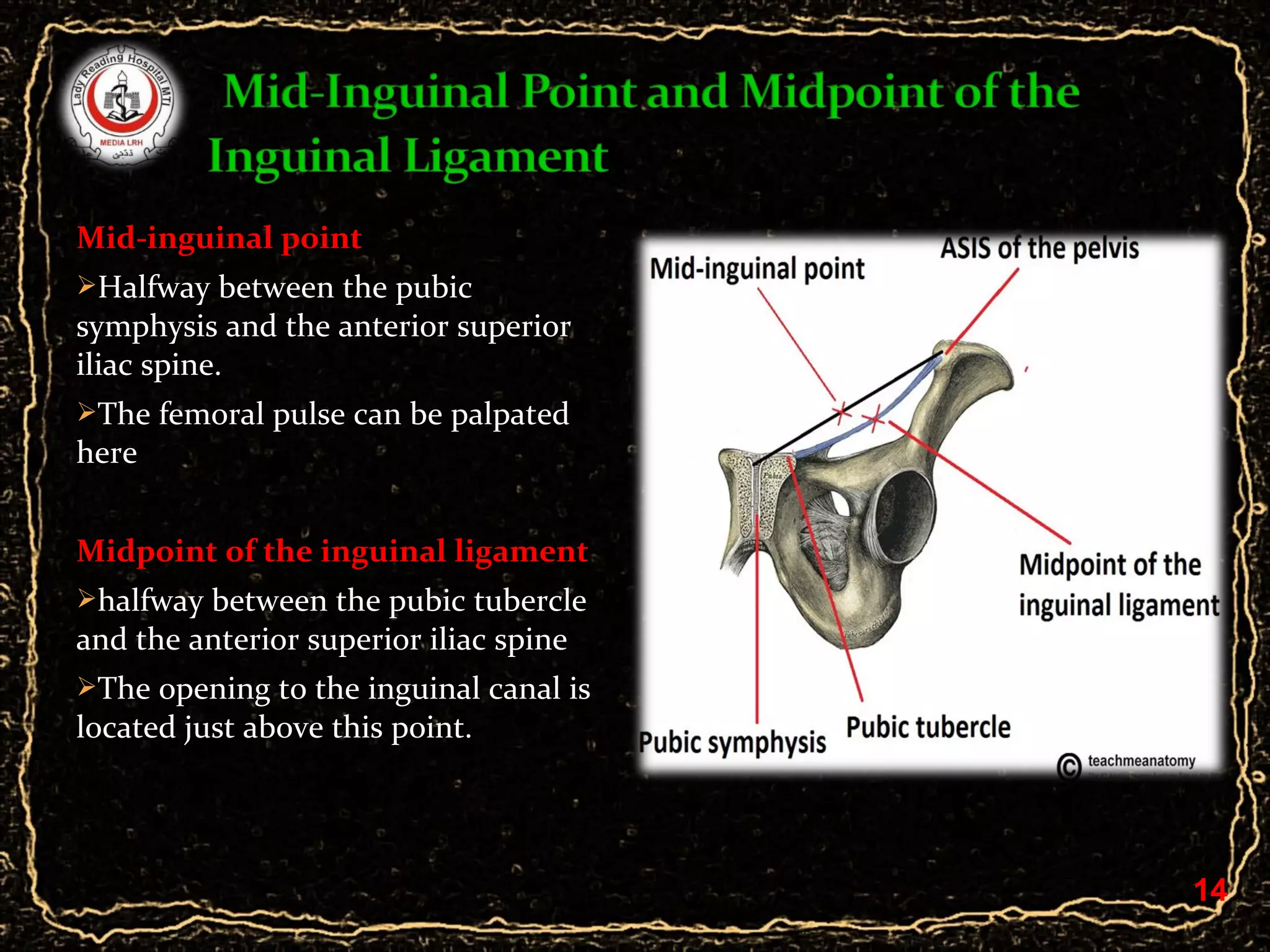 Inguinal Hernia Management, Presentation, by Dr. Shabir Ahmad | PPT