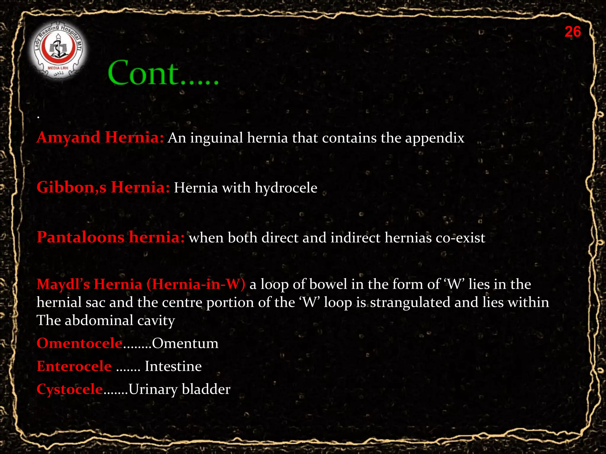 Inguinal Hernia Management, Presentation, by Dr. Shabir Ahmad | PPT