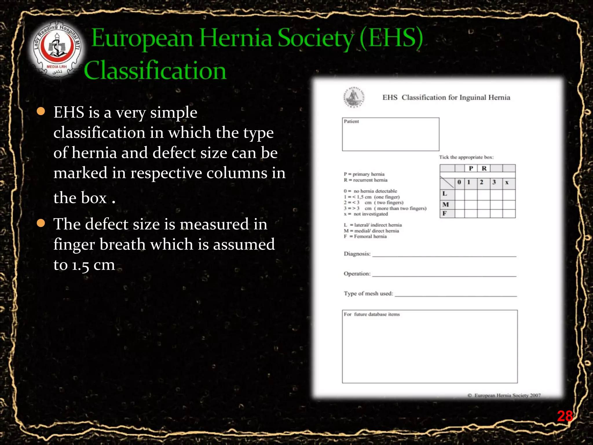 Inguinal Hernia Management, Presentation, by Dr. Shabir Ahmad | PPT