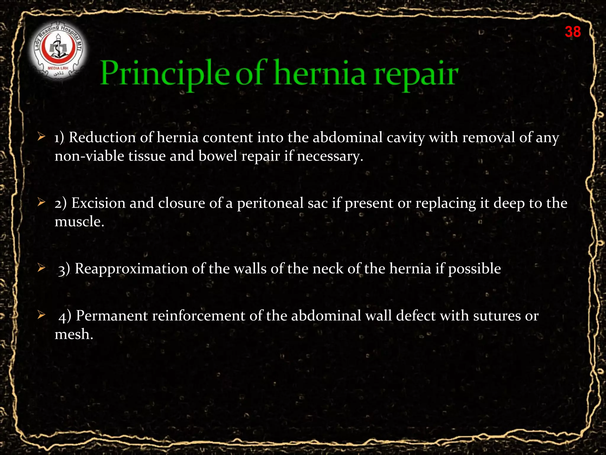 Inguinal Hernia Management, Presentation, by Dr. Shabir Ahmad | PPT