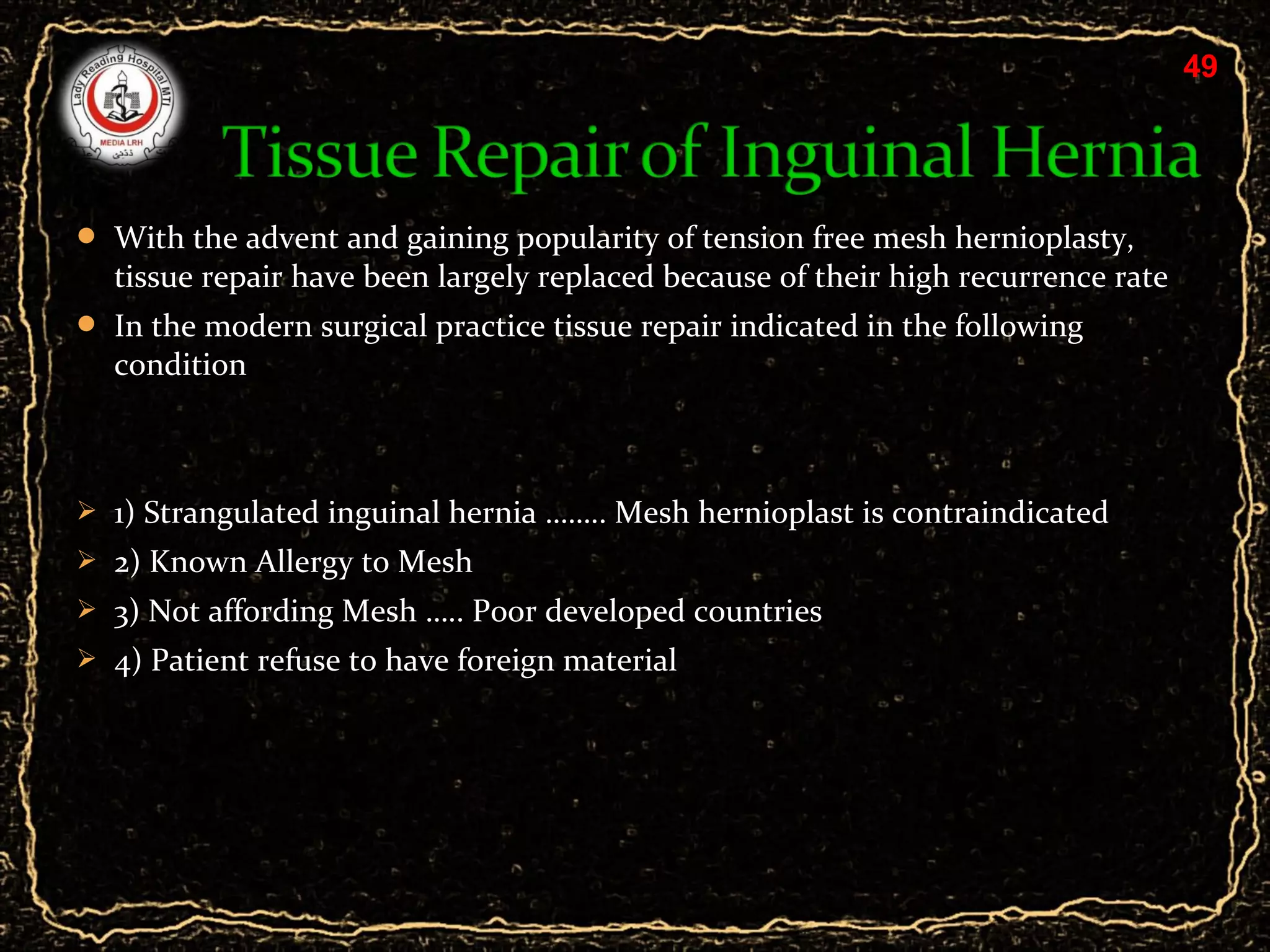 Inguinal Hernia Management, Presentation, by Dr. Shabir Ahmad | PPT