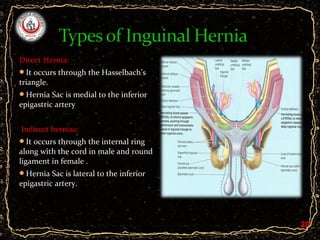 Inguinal Hernia Management, Presentation, by Dr. Shabir Ahmad | PPT
