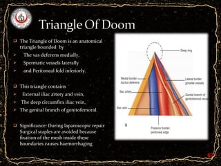 Laparoscopic Inguinal Hernia Repair Triangle Of Doom
