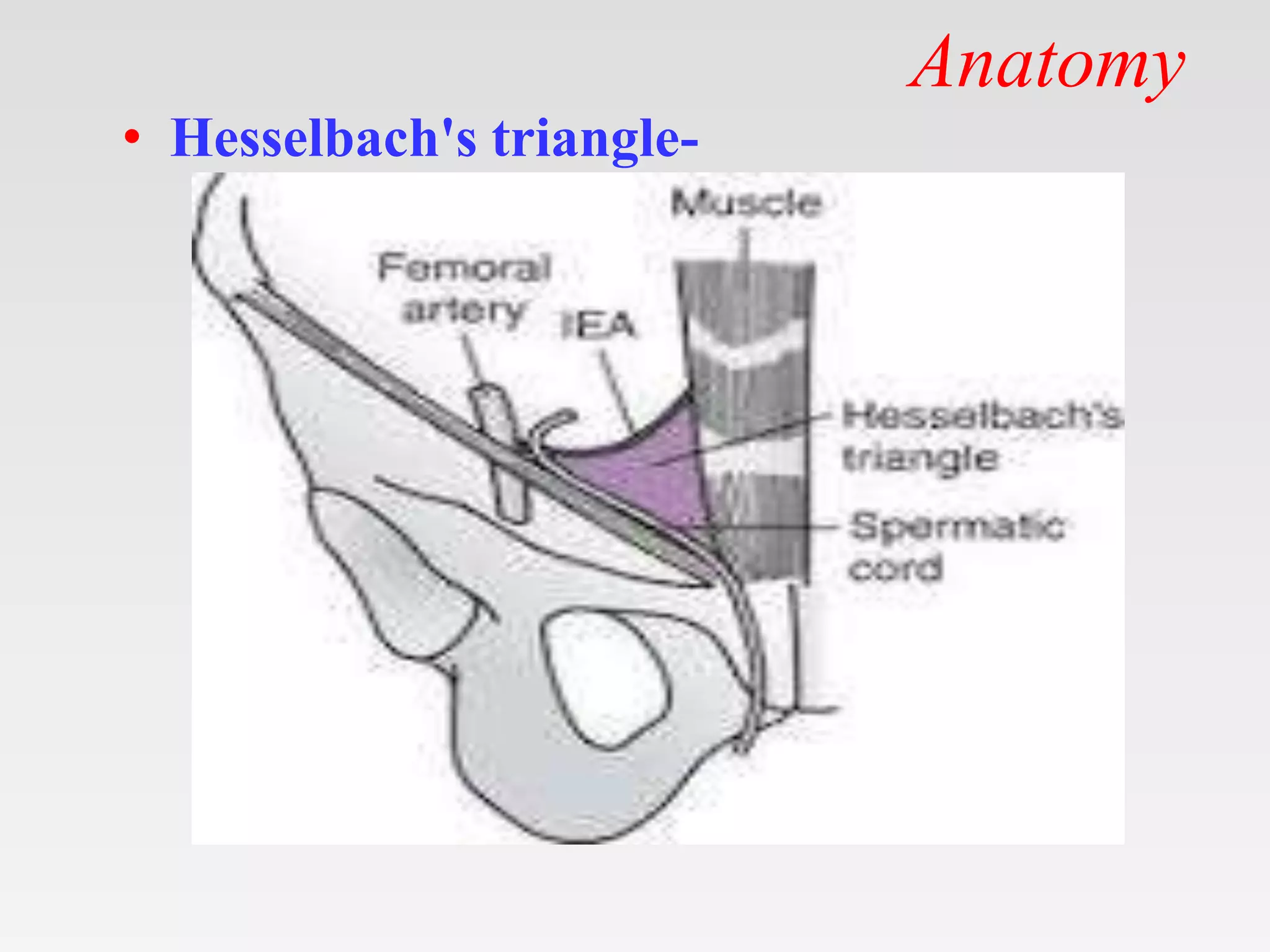Inguinal Hernia.pptx