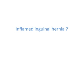 Hernia | PPT