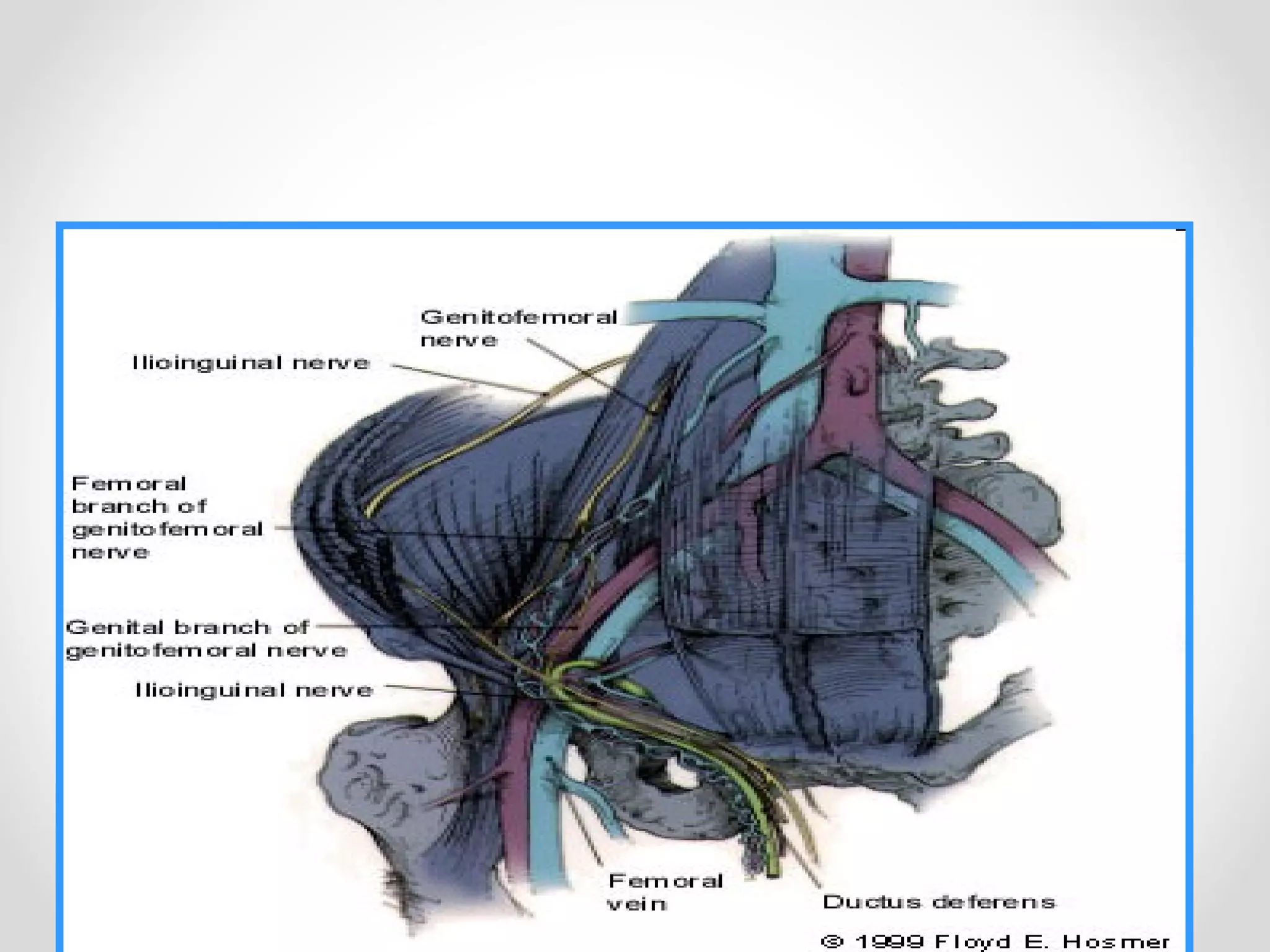Inguinal hernia | PPT