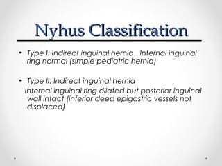Inguinal hernia | PPT