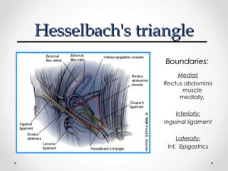 Hesselbach Triangle Boundaries