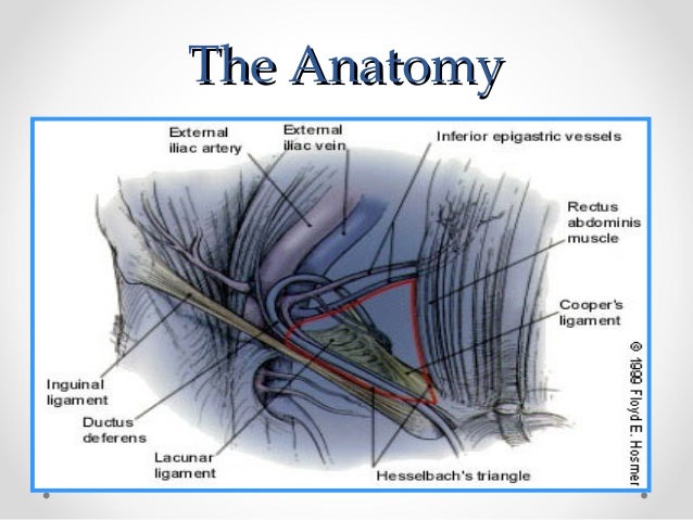 Inguinal Hernia Anatomy Repair Of Femoral Hernia With Mesh