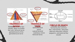 Inguinal Hernia powerpoint - surgery review | PPTX
