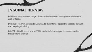 Inguinal Hernia powerpoint - surgery review | PPTX