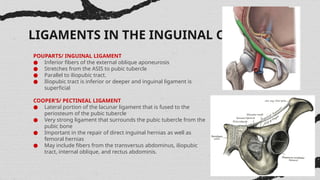 Inguinal Hernia powerpoint - surgery review | PPTX