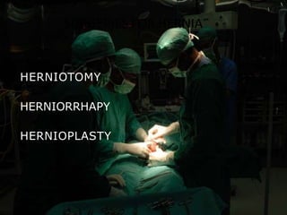 Inguinal hernia repair | PPTX