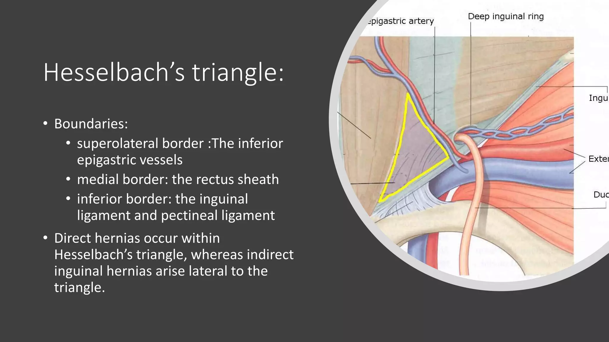 Inguinal Hernia | PPTX