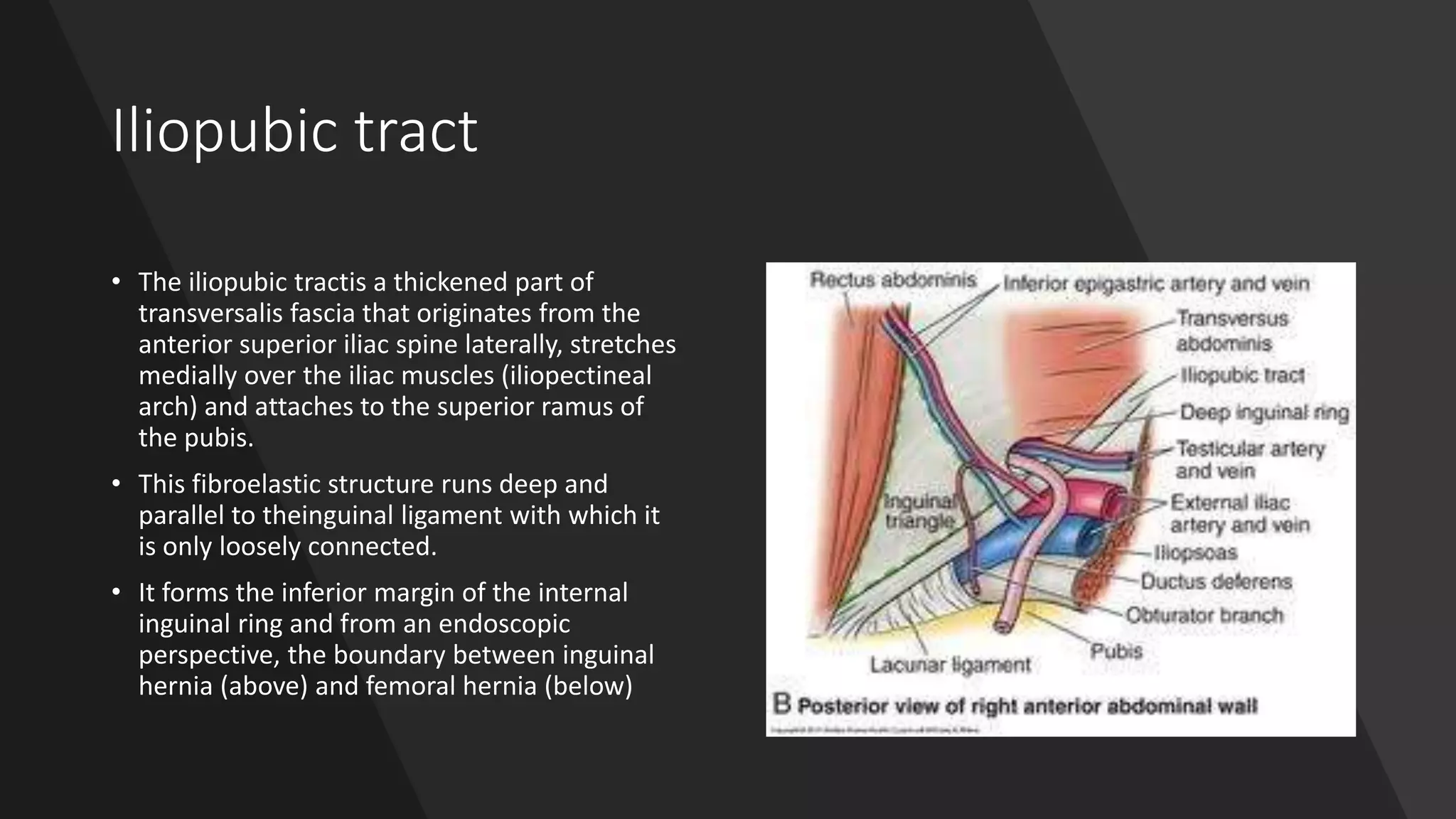 Inguinal Hernia | PPTX