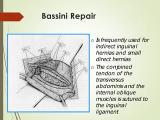 Inguinal hernia repair surgery dr valeria simone southlake general ...