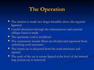 Inguinal hernia lecture............. .ppt